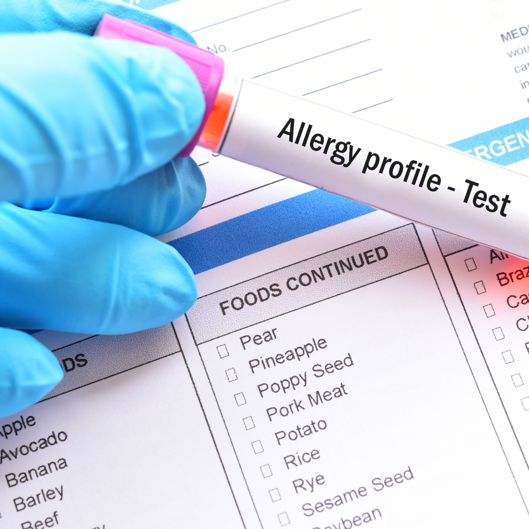Blood Test Vs. Skin Test For Allergies: Which One Should You Get?